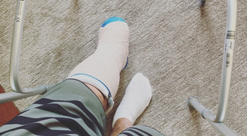 Understanding Transmetatarsal Amputation: Procedure, Recovery, and ...